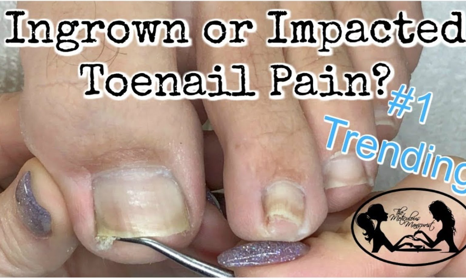 Why Do We Have Fingernails and Toenails? – Dtclinis
